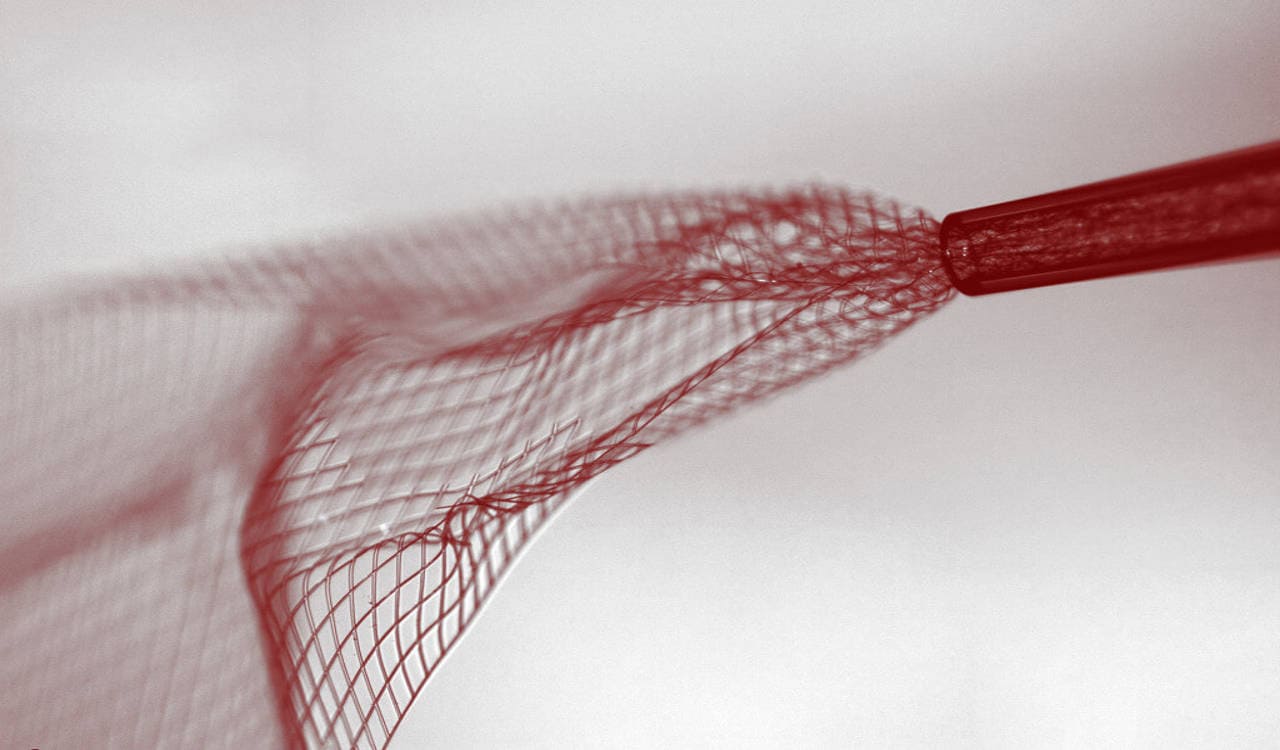 Mesh allows brain mapping of individual neurons - Springwise