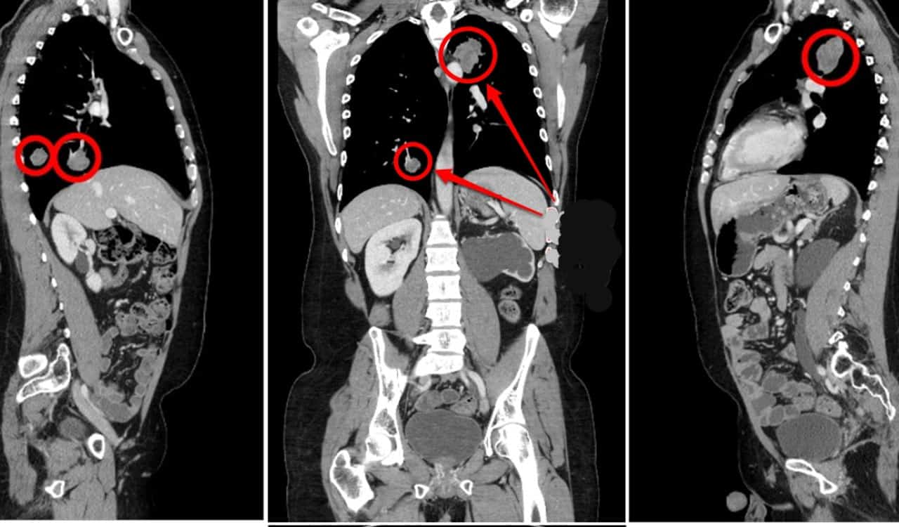 AI analyzes medical scans for in-depth results - Springwise