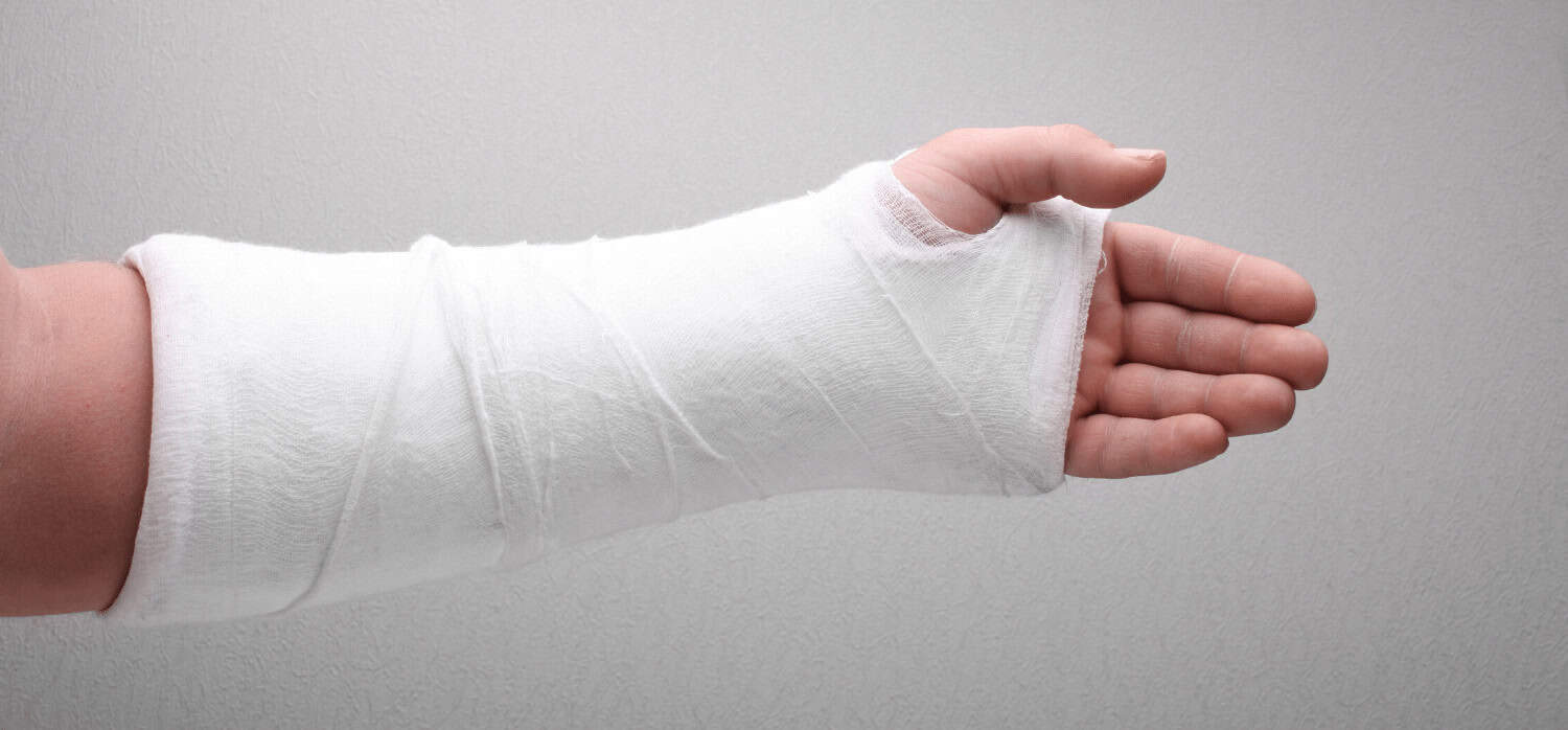 Washable mesh sleeve offers alternative to plaster casts - Springwise
