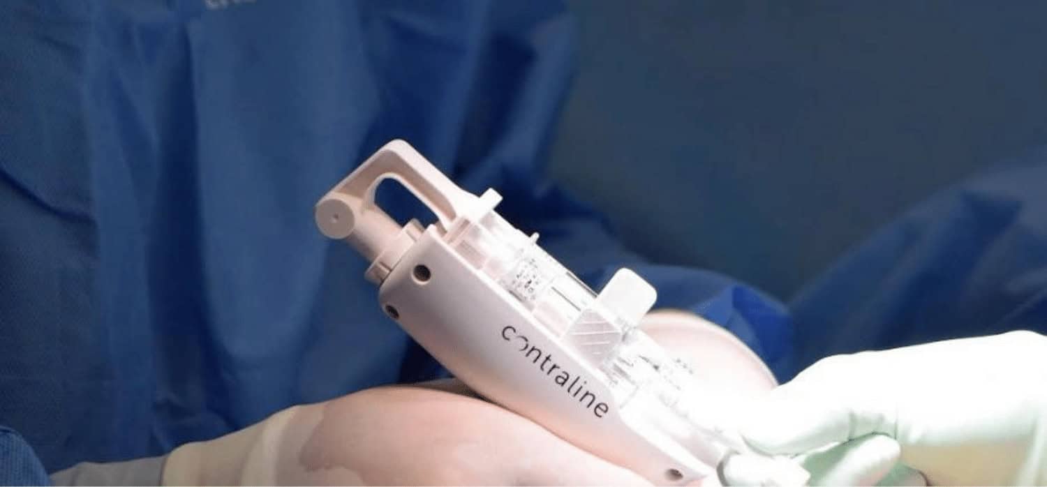 An injectable hydrogel for non-permanent male contraception - Springwise