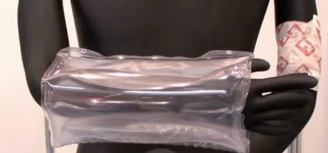 Inflatable cast can be applied anywhere, and by anyone - Springwise